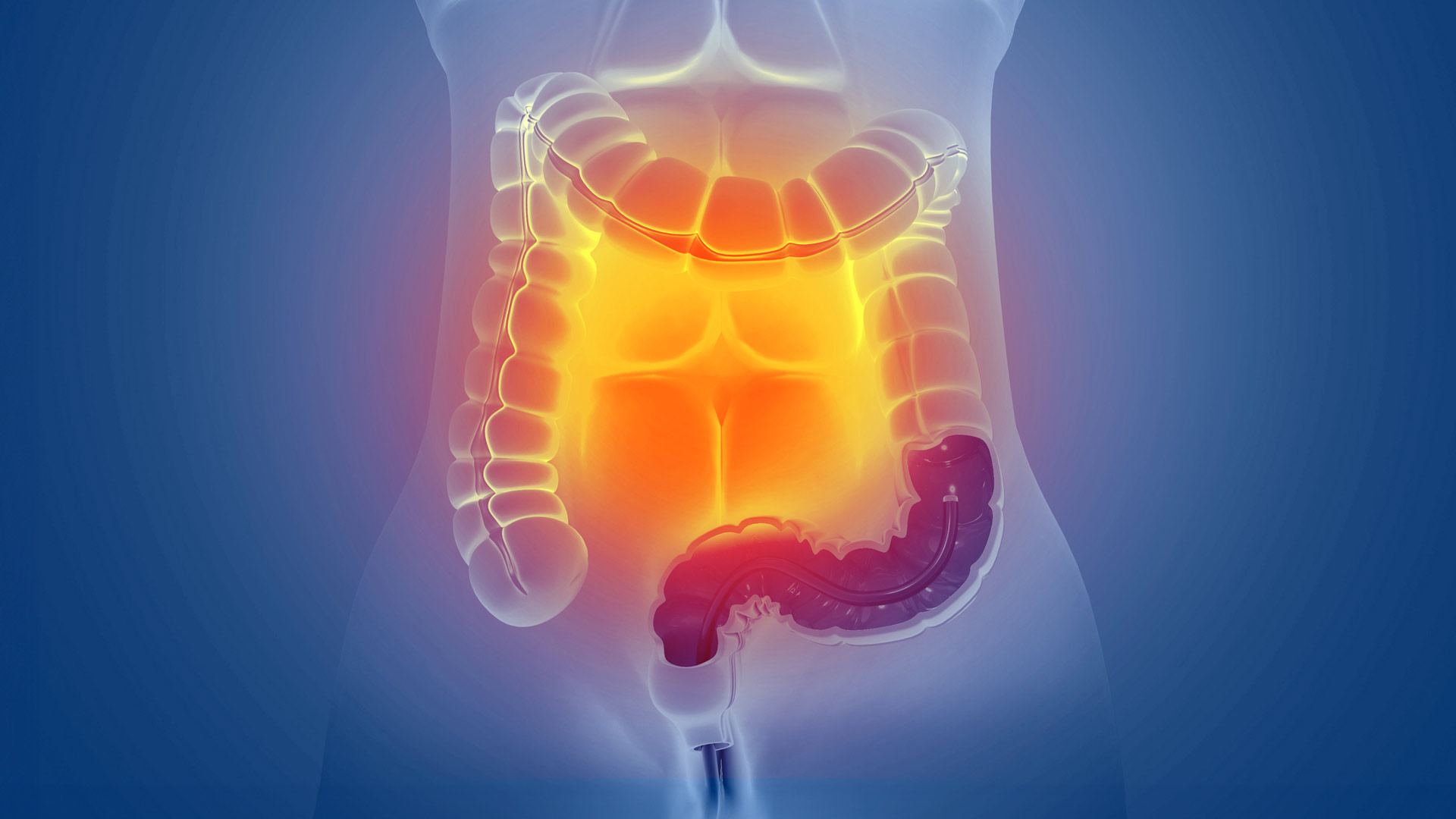 Colonoscopia: Guia Básico para Entender o Procedimento - Gastroen