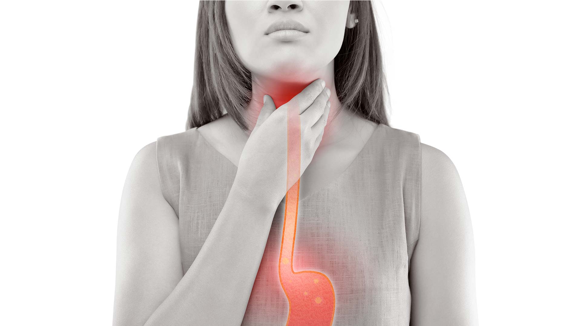 Doença do Refluxo Gastroesofágico: Causas, Sintomas e Tratamentos ...