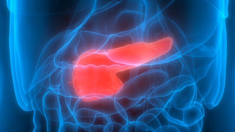 Pancreatite: Causas, Sintomas e Tratamentos - Gastroen